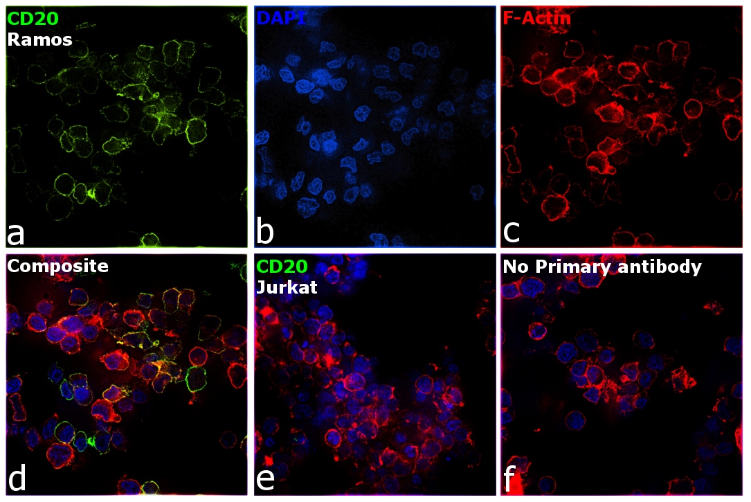 CD20 Antibody (MA5-16334)