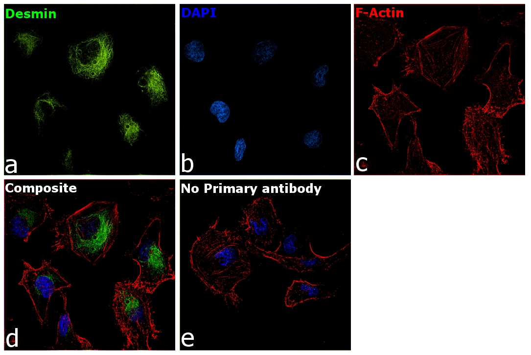 Desmin Antibody (MA5-16357)