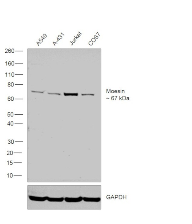 Moesin Antibody (MA5-17130)