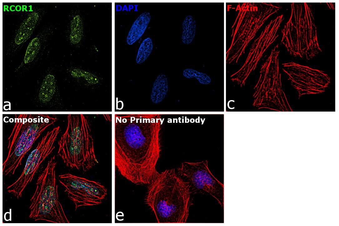 RCOR1 Antibody (MA5-24297)