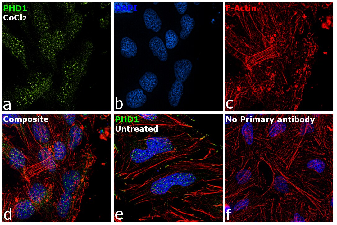 PHD1 Antibody (MA5-24853)