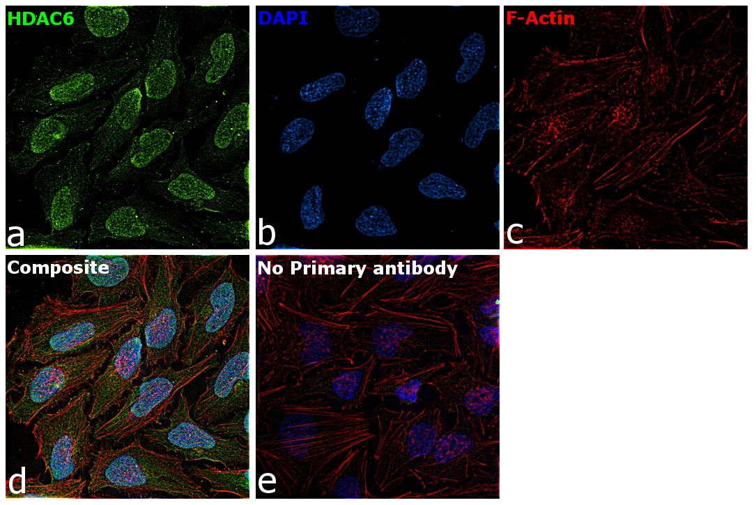 HDAC6 Antibody (MA5-25317)