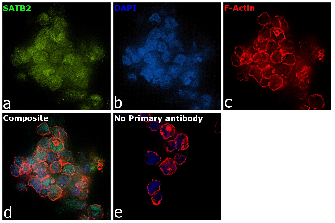 SATB2 Antibody (MA5-26490)