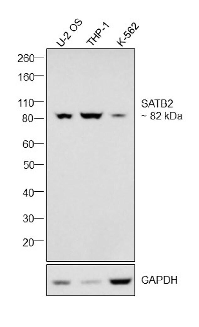 SATB2 Antibody (MA5-26490)