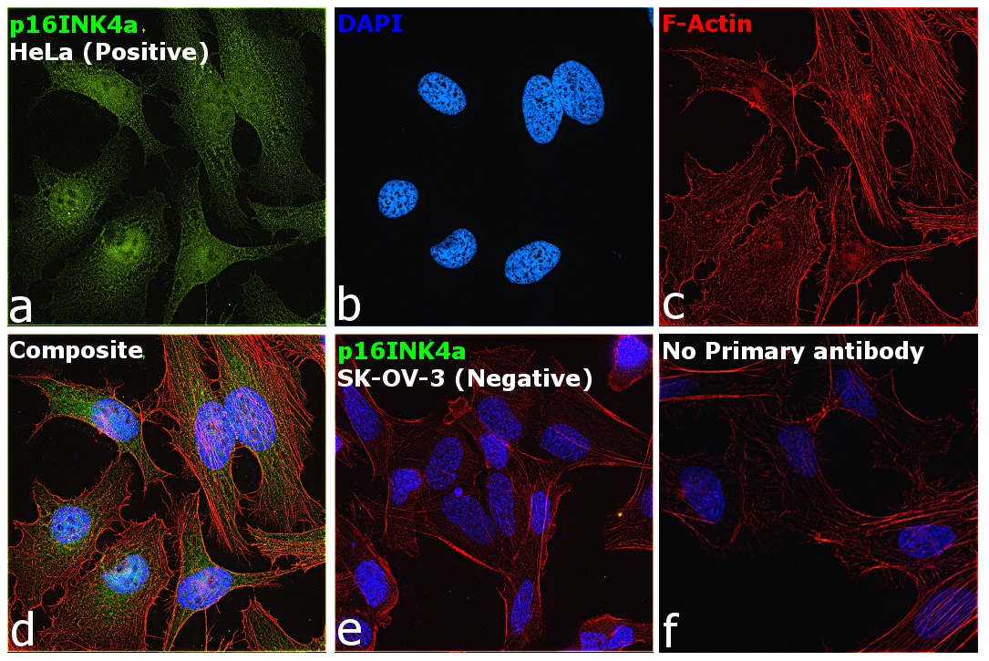 p16INK4a Antibody (MA5-27905)