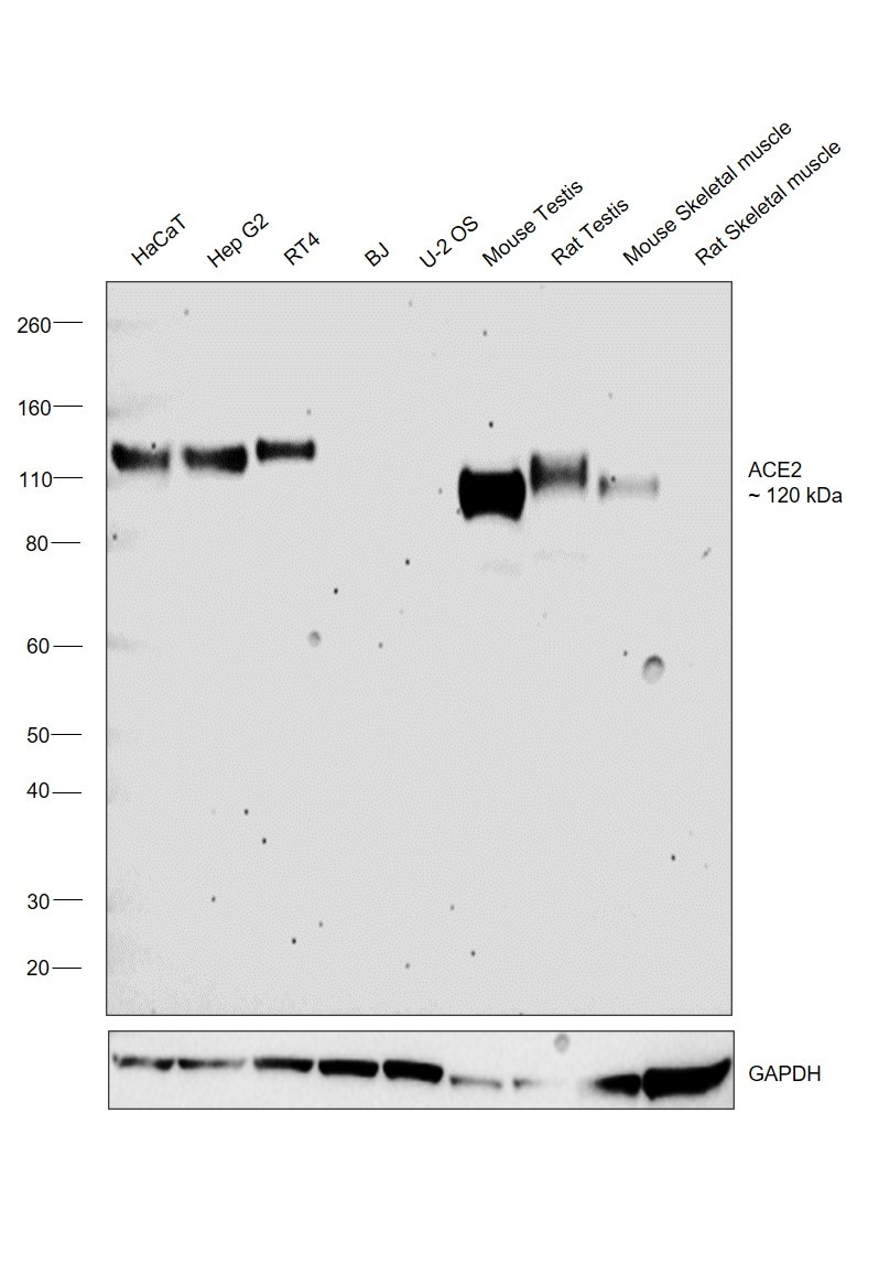 ACE2 Antibody (MA5-32307)
