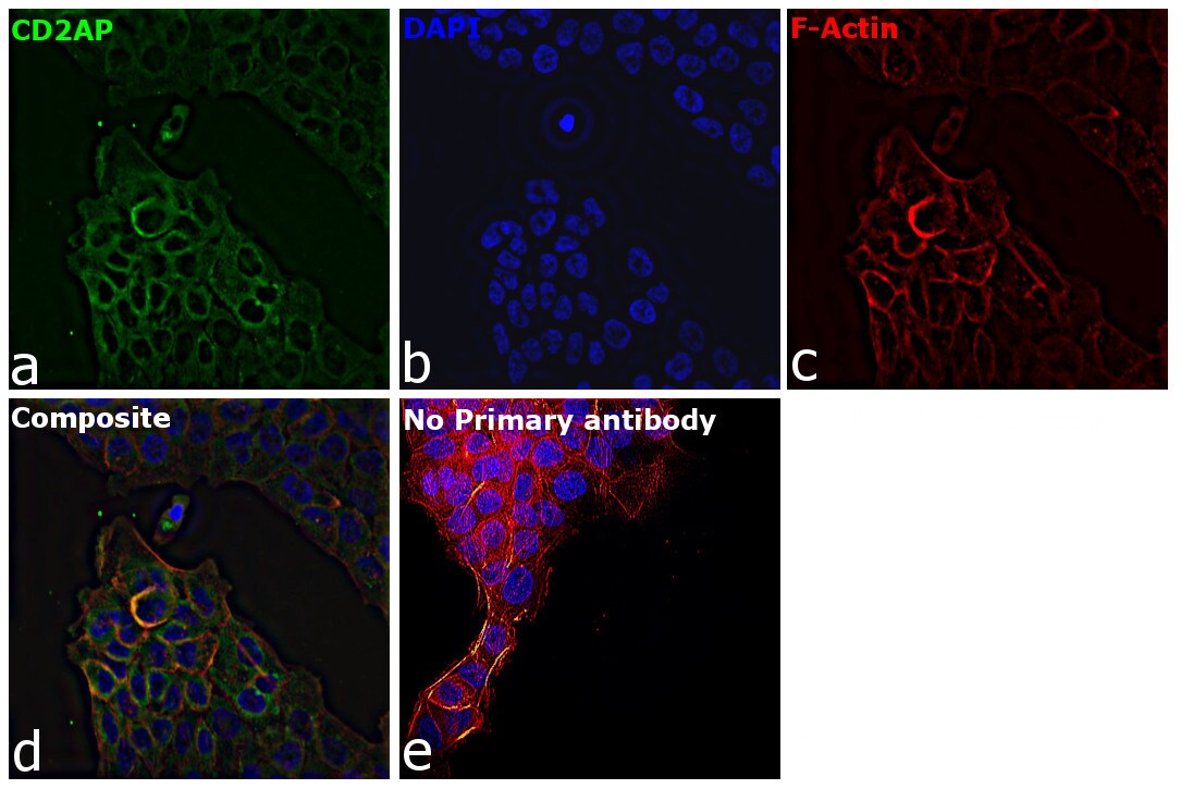 CD2AP Antibody (MA5-33009)