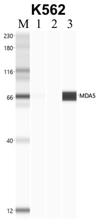 MDA5 Antibody (700360)