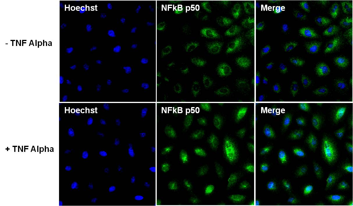 Nfkb P50 Antibody Ma5 15870