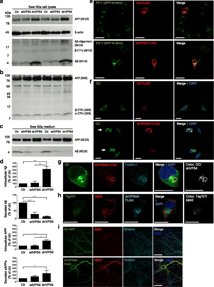 Amyloid Precursor Protein Antibody (OMA1-03132)