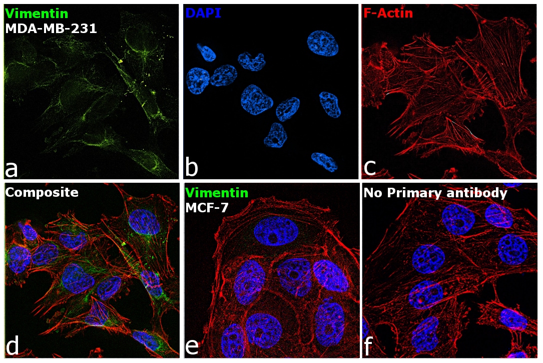 Vimentin Antibody (OMA1-06001)