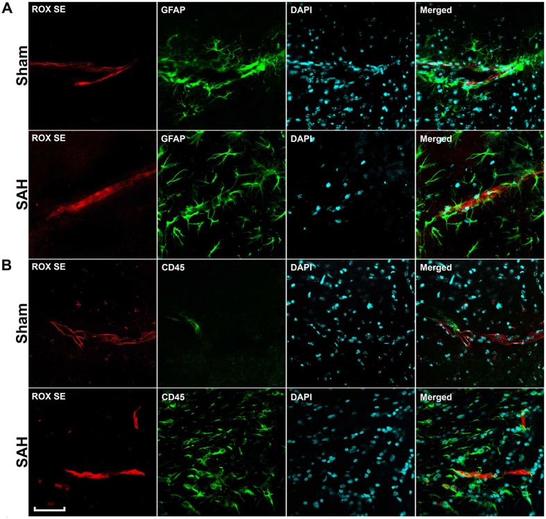 GFAP Antibody (OPA1-06100)