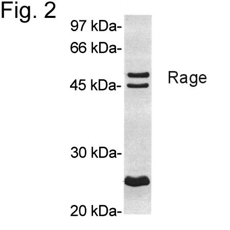 RAGE Antibody (PA1-075)
