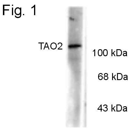 Phospho-TAOK2 (Ser181) Antibody (PA1-4643)