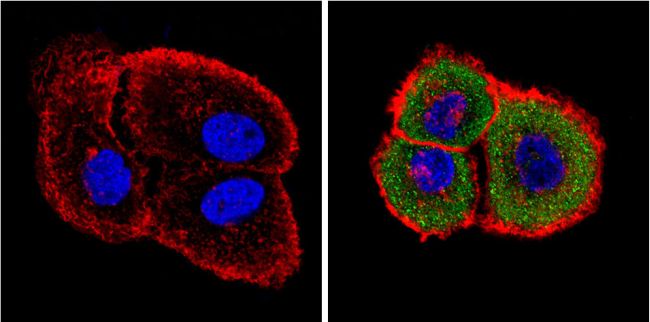 Endostatin Antibody (PA1-601)
