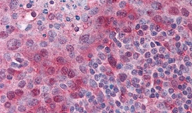 PYCARD Antibody (PA1-9010)