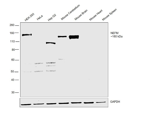 NEFM Antibody (PA1-10001)
