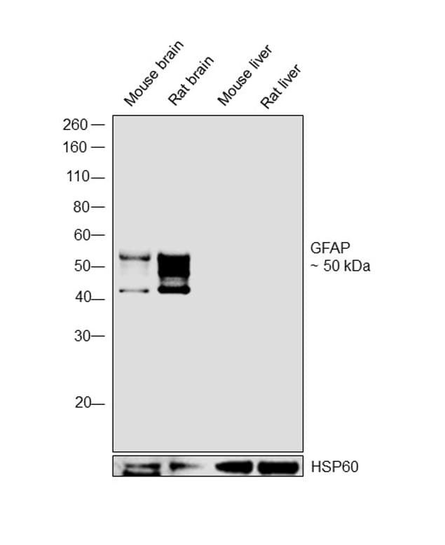 GFAP Antibody (PA1-10004)