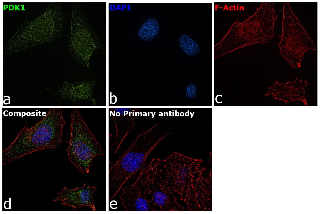 PDK1 Antibody (PA1-16945)
