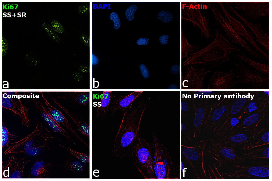 Ki-67 Antibody (PA1-21520)