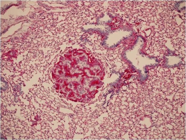 Placental Alkaline Phosphatase Antibody (PA1-29125)