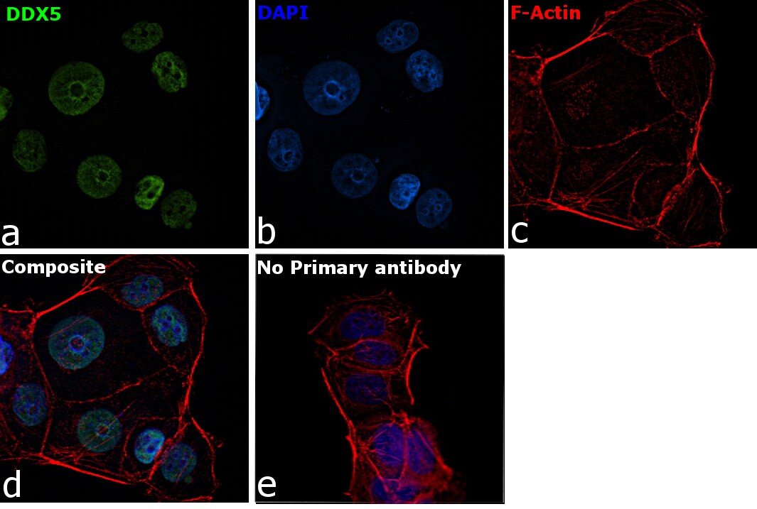 DDX5 Antibody (PA1-31019)