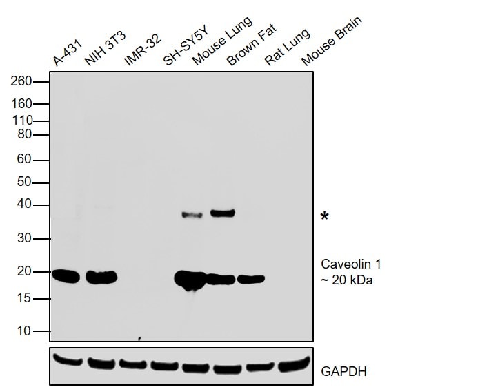 Caveolin 1 Antibody (PA5-32297)