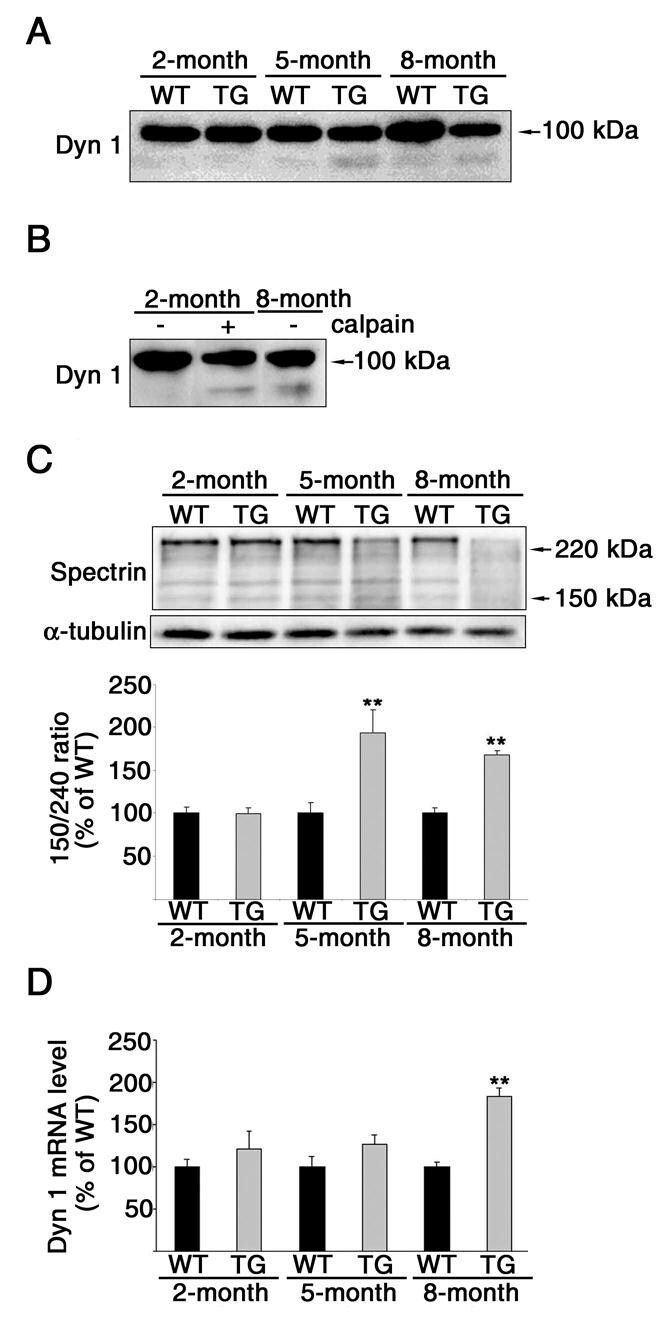 Dynamin 1 Antibody