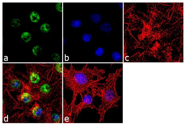 FOXC1 Antibody (PA1-807)