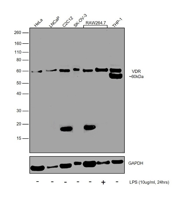 VDR Antibody (PA1-9116)