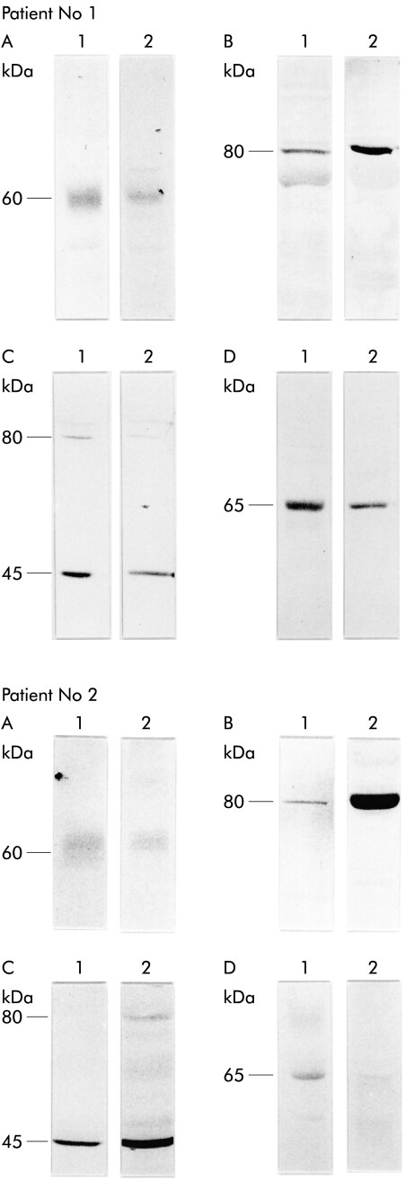 SSTR2 Antibody