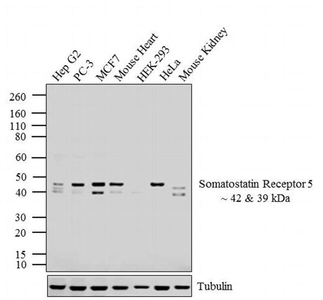 SSTR5 Antibody (PA3-112)