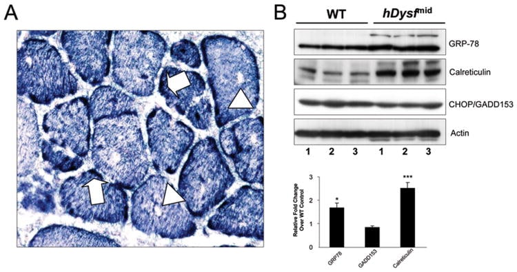 Calreticulin Antibody