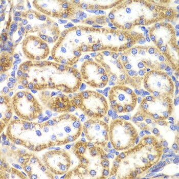 RANKL Antibody (PA5-110268)
