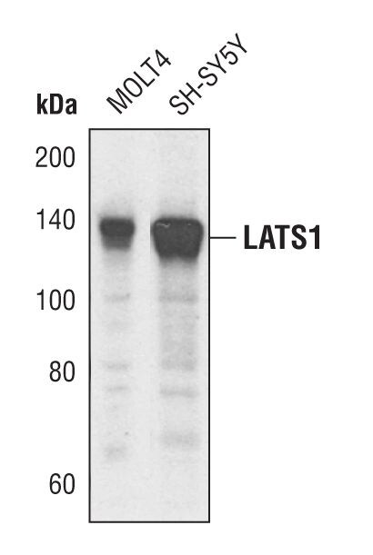 LATS1 Antibody (PA5-17142)