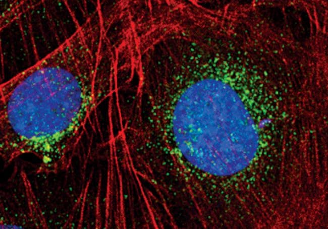 EEA1 Antibody (PA5-17228)