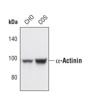 alpha Actinin 1 Antibody (PA5-17308)