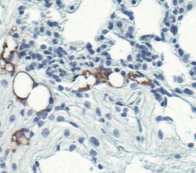 ATGL Antibody (PA5-17436)
