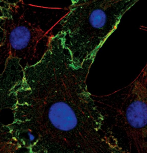 PKC alpha Antibody (PA5-17551)