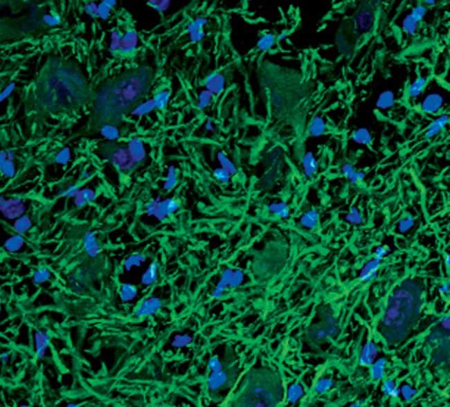 MAP2 Antibody (PA5-17646)