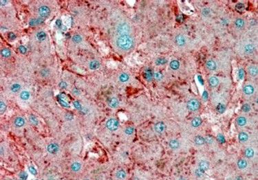 APOE Antibody (PA5-18361)