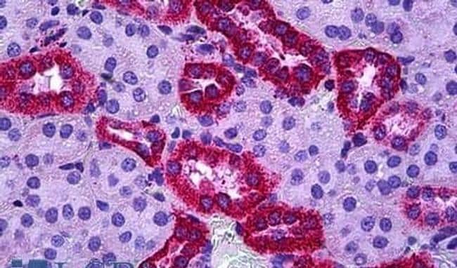 TSPO Antibody (PA5-19088)