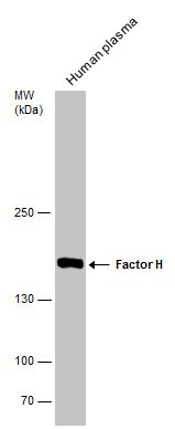 Complement Factor H Antibody (PA5-21302)