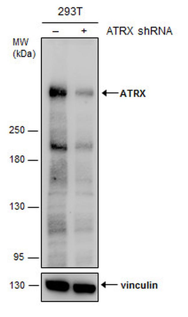 ATRX Antibody (PA5-21348)