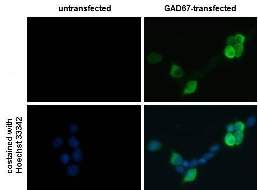GAD67 Antibody (PA5-21397)