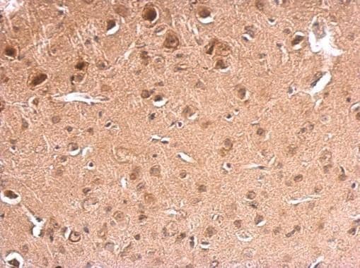 GAD67 Antibody (PA5-21397)