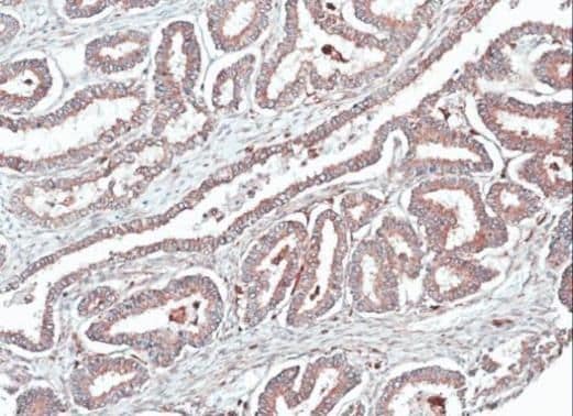 HOMER1 Antibody (PA5-21487)