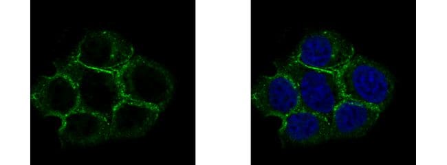 Caveolin 2 Antibody (PA5-21927)