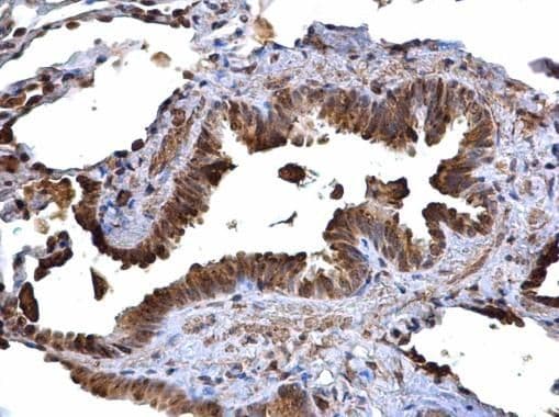 CD74 Antibody (PA5-22113)