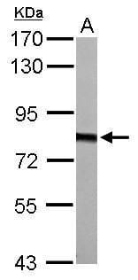 HADHA Antibody (PA5-27348)
